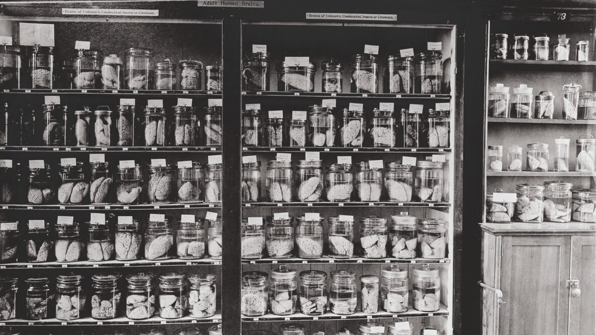 Brains! Collection Is a (Slightly Spooky) Artifact of an Earlier Era ...