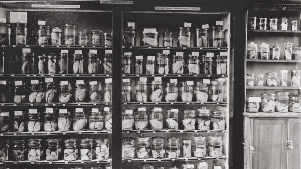 Brains! Collection Is a (Slightly Spooky) Artifact of an Earlier Era ...