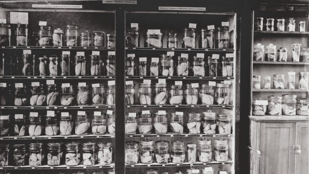 Brains! Collection Is a (Slightly Spooky) Artifact of an Earlier Era ...