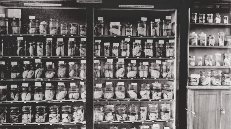 Brains! Collection Is a (Slightly Spooky) Artifact of an Earlier Era ...