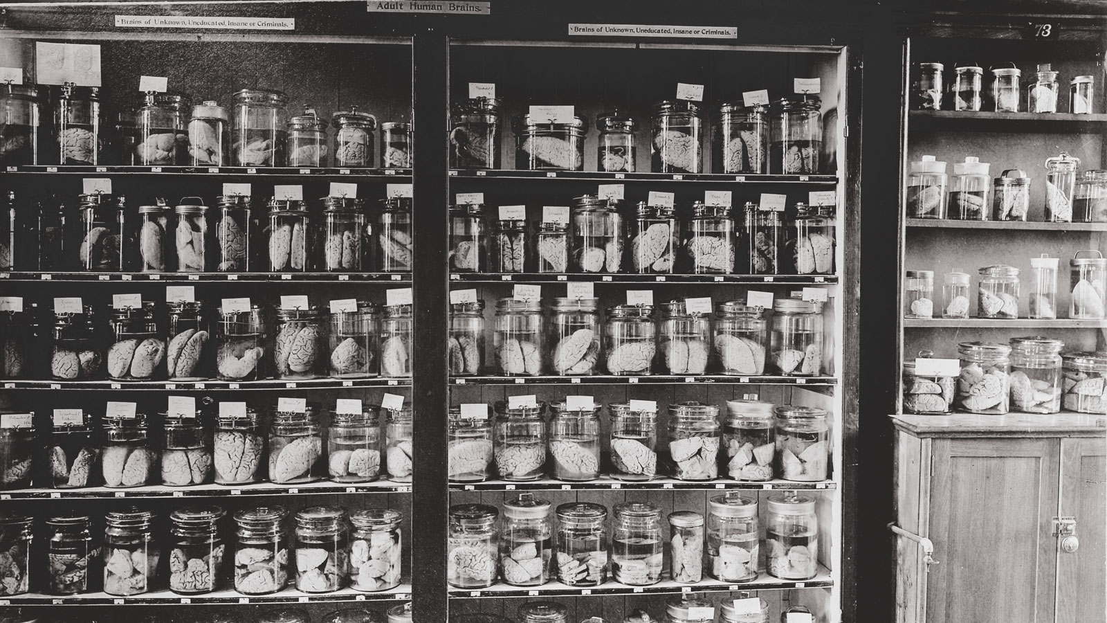 Brains! Collection Is a (Slightly Spooky) Artifact of an Earlier Era ...